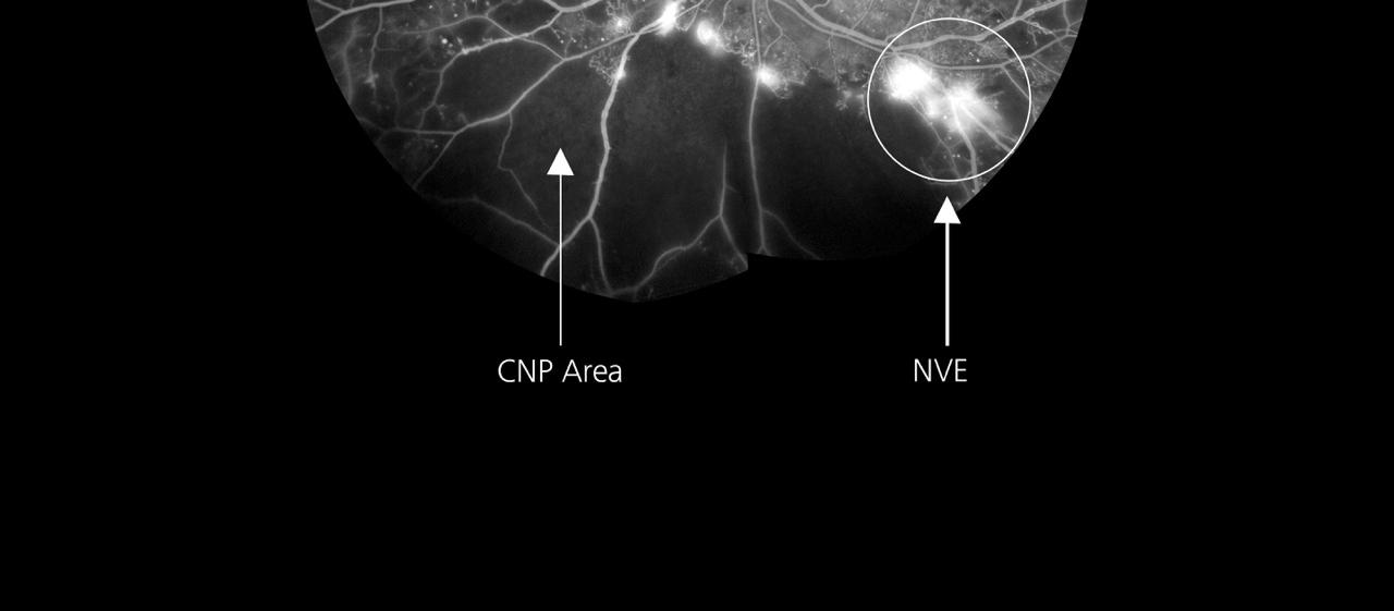 ZEISS CLARUS 700 Case Studies
