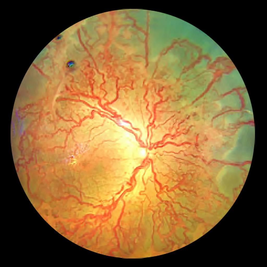 ZEISS CLARUS 700 Case Studies