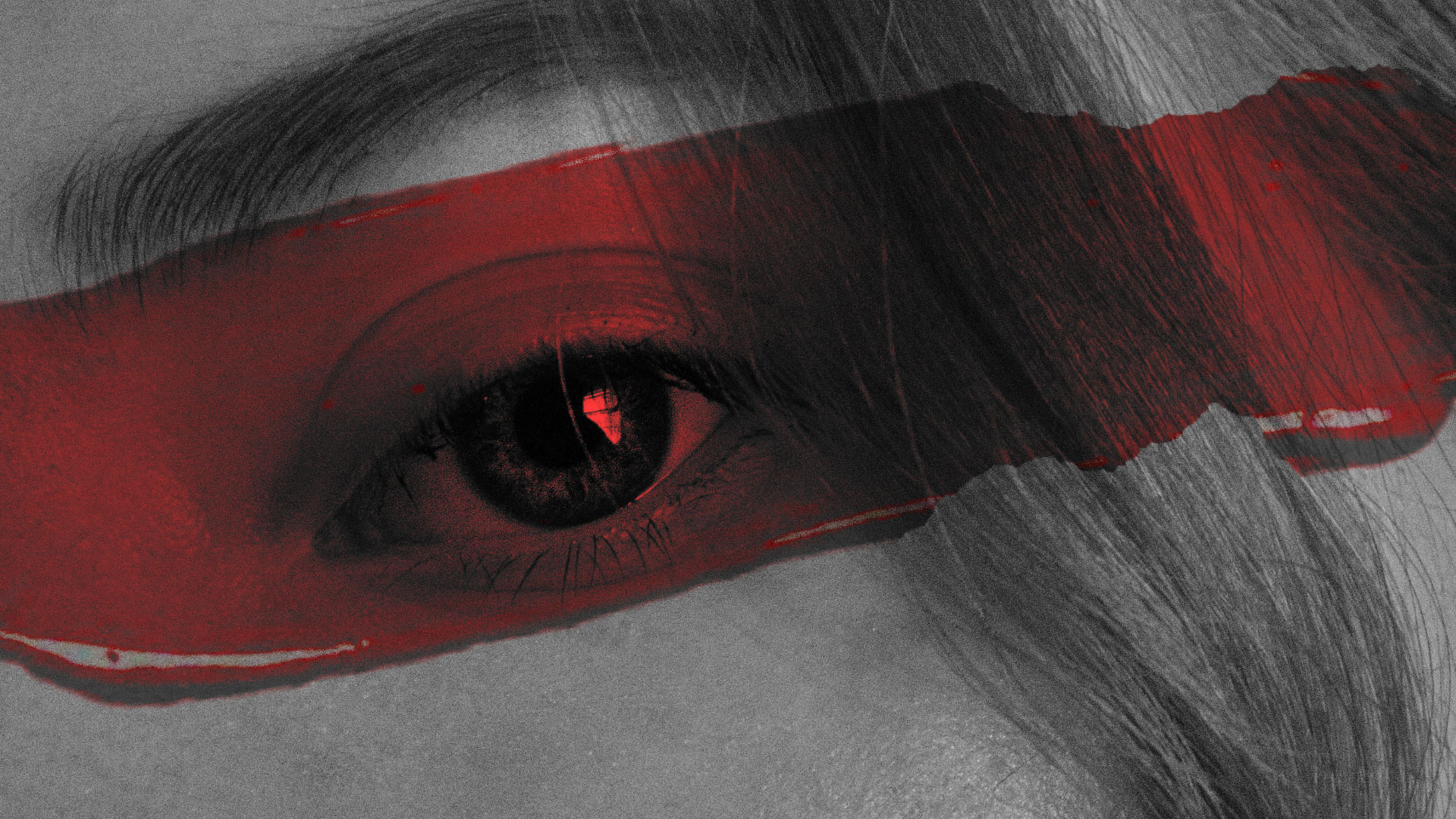 Conjunctivitis, styes, eyelid infection, etc.: The most common eye ...