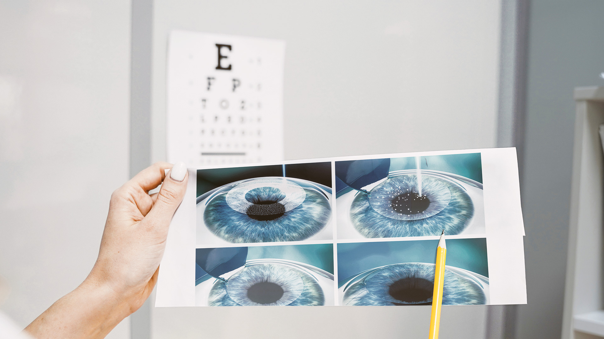 The LASIK surgery step-by-step guide | ZEISS
