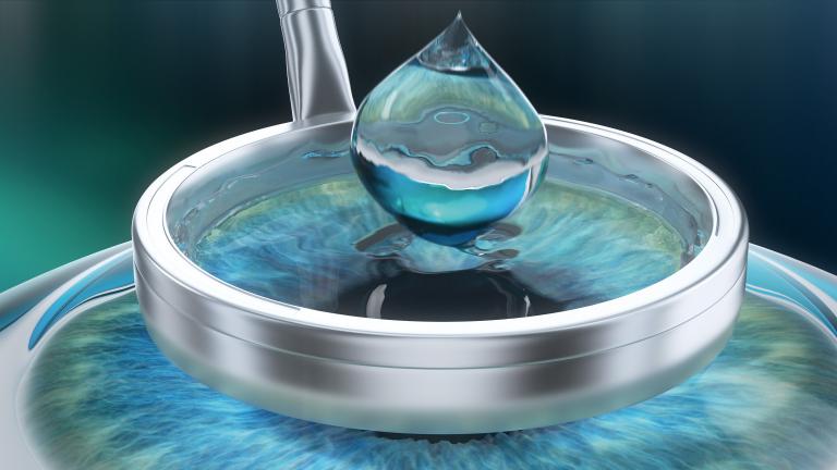 The PRK procedure in detail | ZEISS