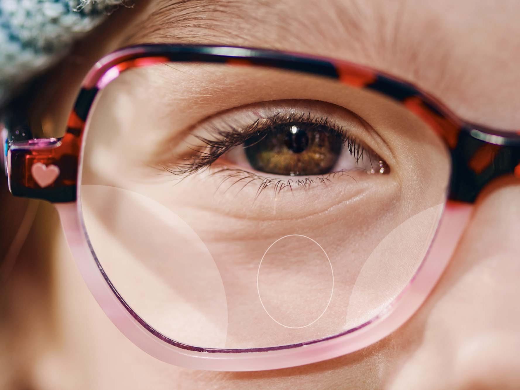 ZEISS Myopia management lenses